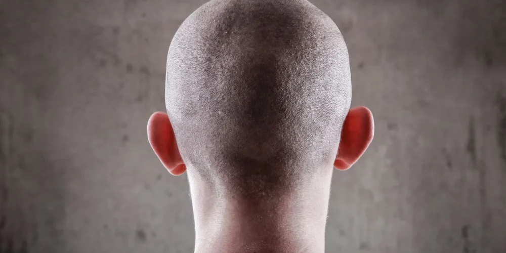 Is Adin Ross Bald for Andrew Tate!? - EmergeWomanMagazine